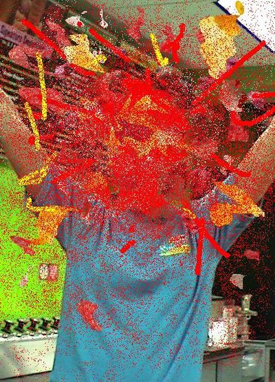 Sudden Exploded Head Syndrome - Uncyclopedia, the content-free encyclopedia